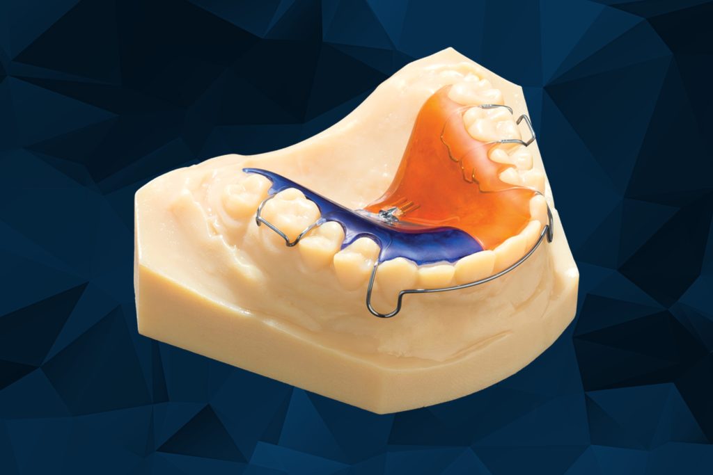 Orthodontics and 3D Printing | Increase Profitability and Efficiency