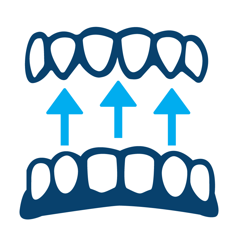 KeyPrint KeyModel Ultra™ 3D Printing Resin for Dental and Ortho Models