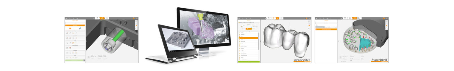 FOLLOW-ME! hyperDENT® - Proto3000 Dental