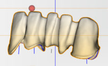 FOLLOW-ME! hyperDENT® - Proto3000 Dental