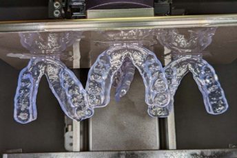 SmileGuard | 3D Printing Resin for Bite Splints, Mouth and Night Guards